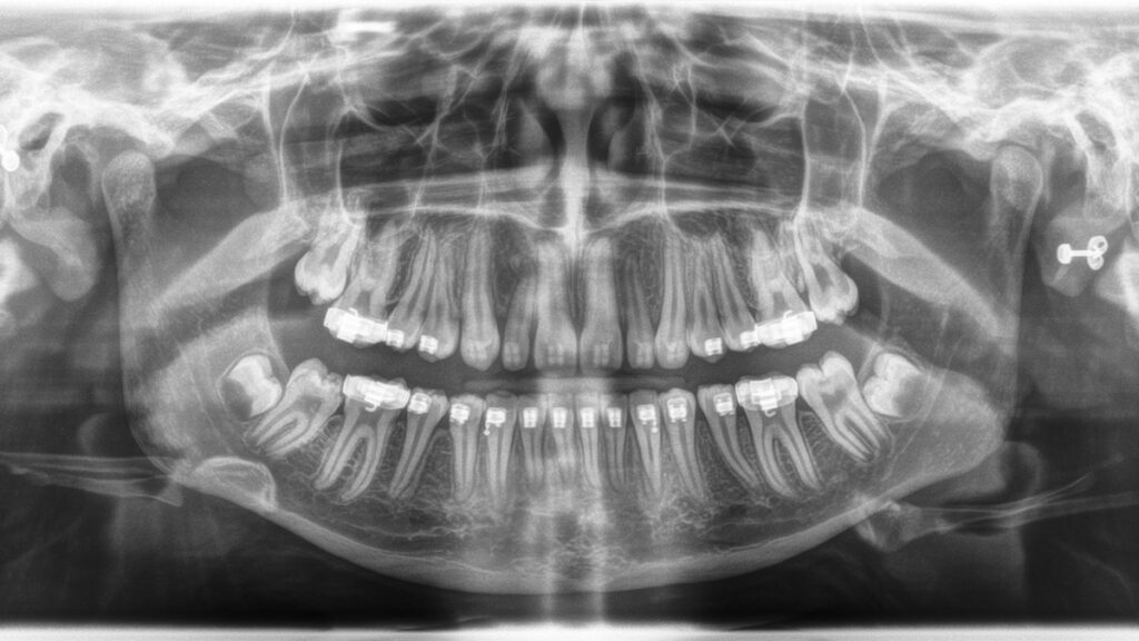 Orthophos XG 3D – Tu equipo dental